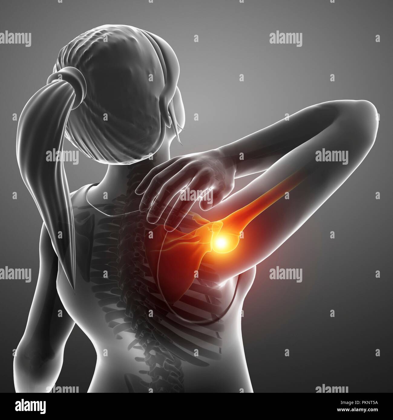 Woman with a painful shoulder, computer illustration Stock Photo - Alamy