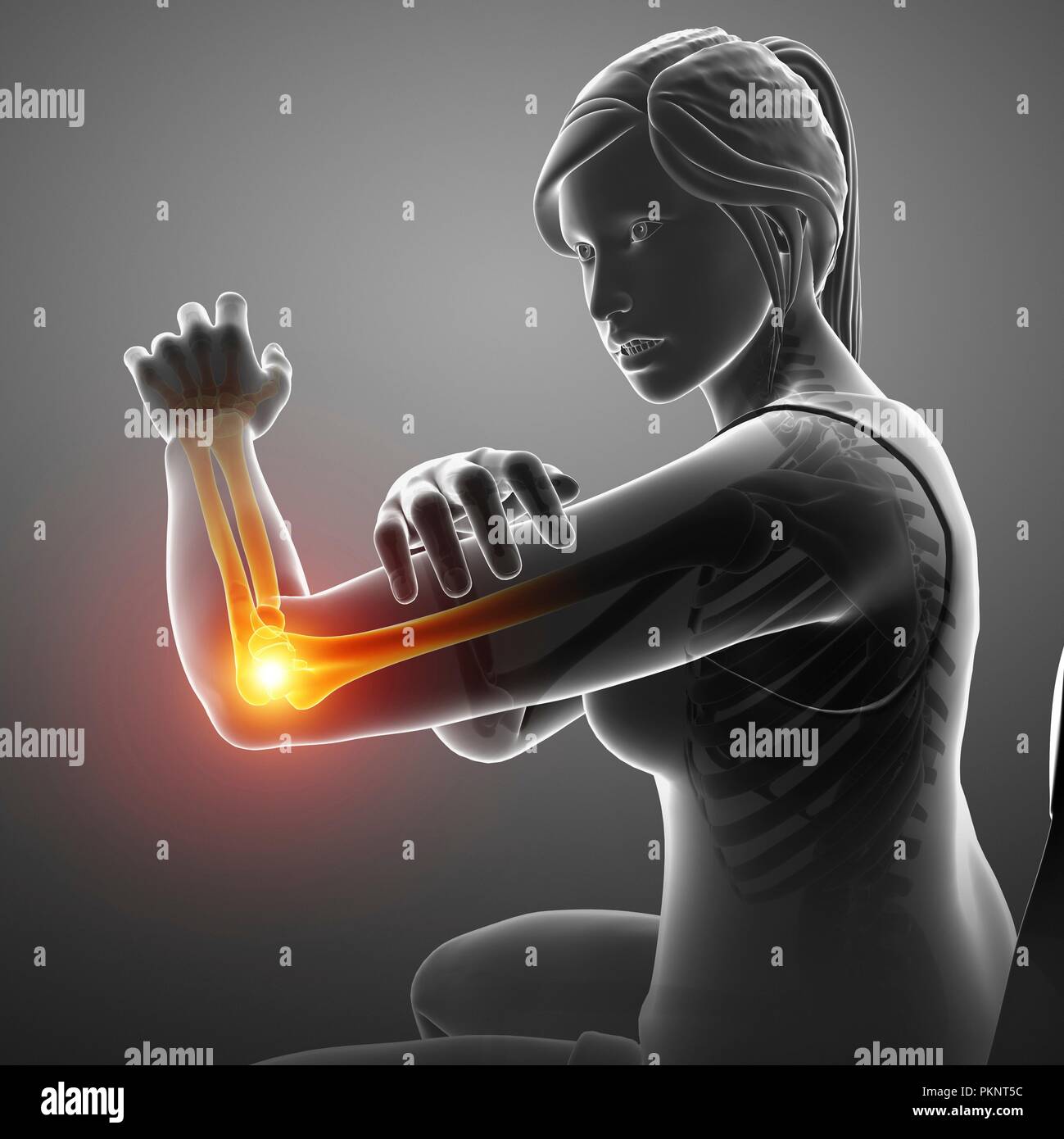 Woman with elbow pain, computer illustration Stock Photo - Alamy