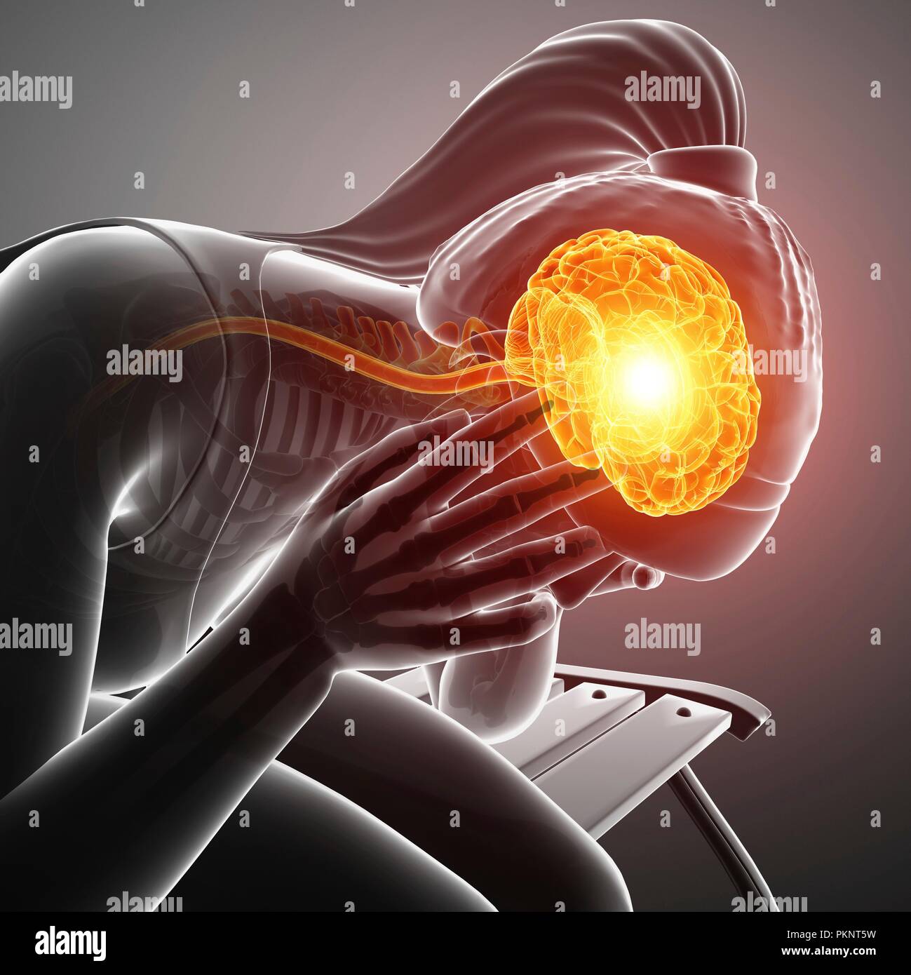 Woman with headache, computer illustration Stock Photo - Alamy