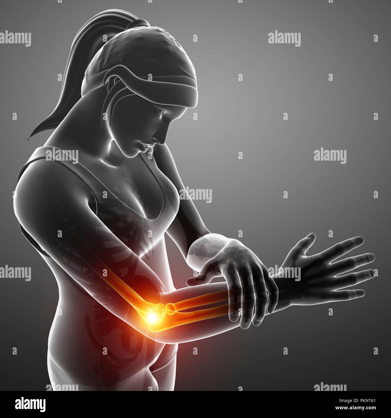Woman with elbow pain, computer illustration Stock Photo - Alamy