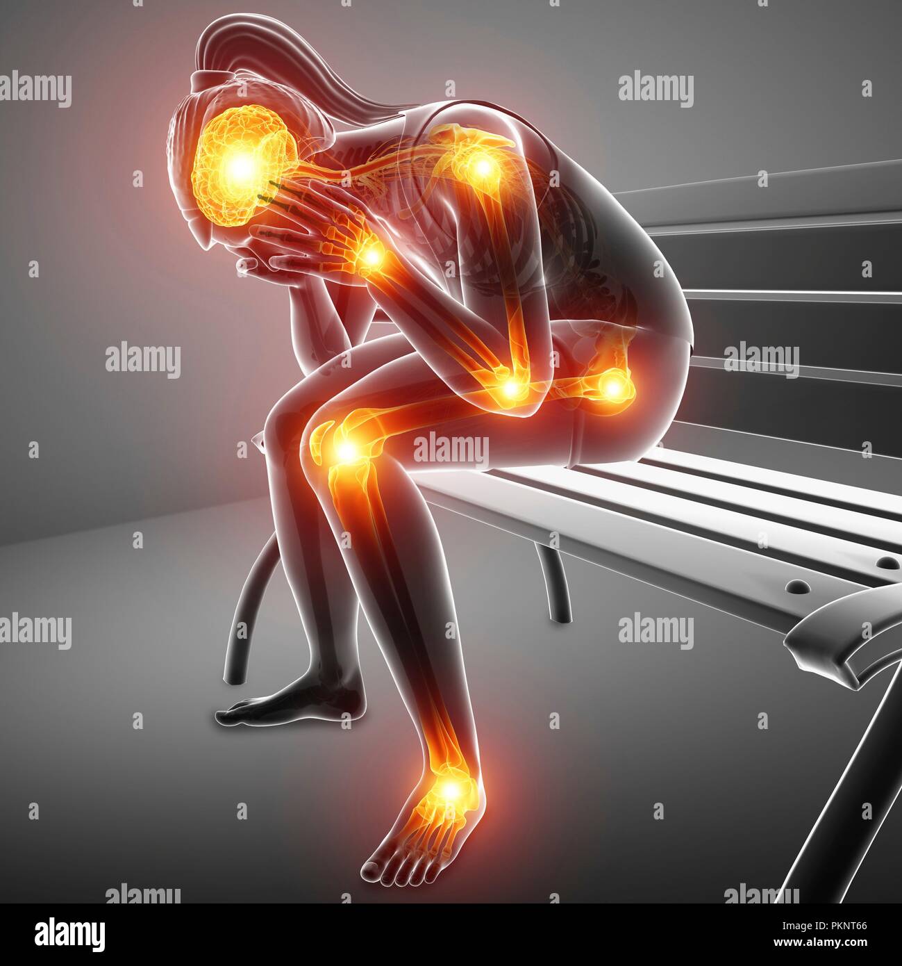 Woman with joint pain, computer illustration Stock Photo - Alamy