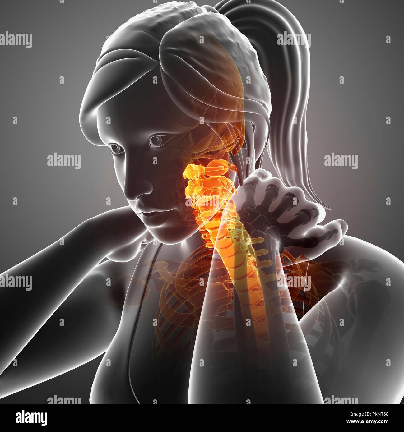 Woman with neck pain, computer illustration Stock Photo - Alamy
