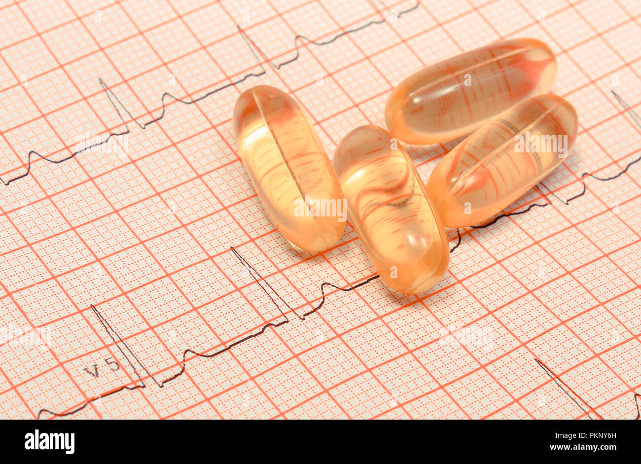 Electrocardiogram graph ekg heart rhythm and tablets or supplements ...