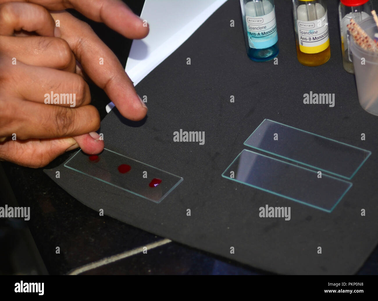 Medical doctor make analysis of blood samples Stock Photo - Alamy