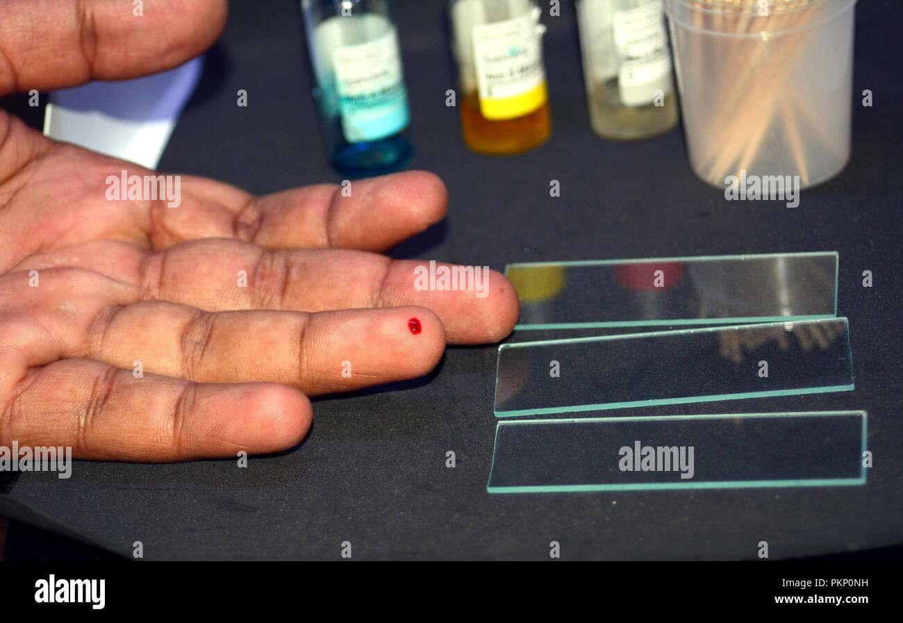 Medical doctor make analysis of blood samples Stock Photo - Alamy