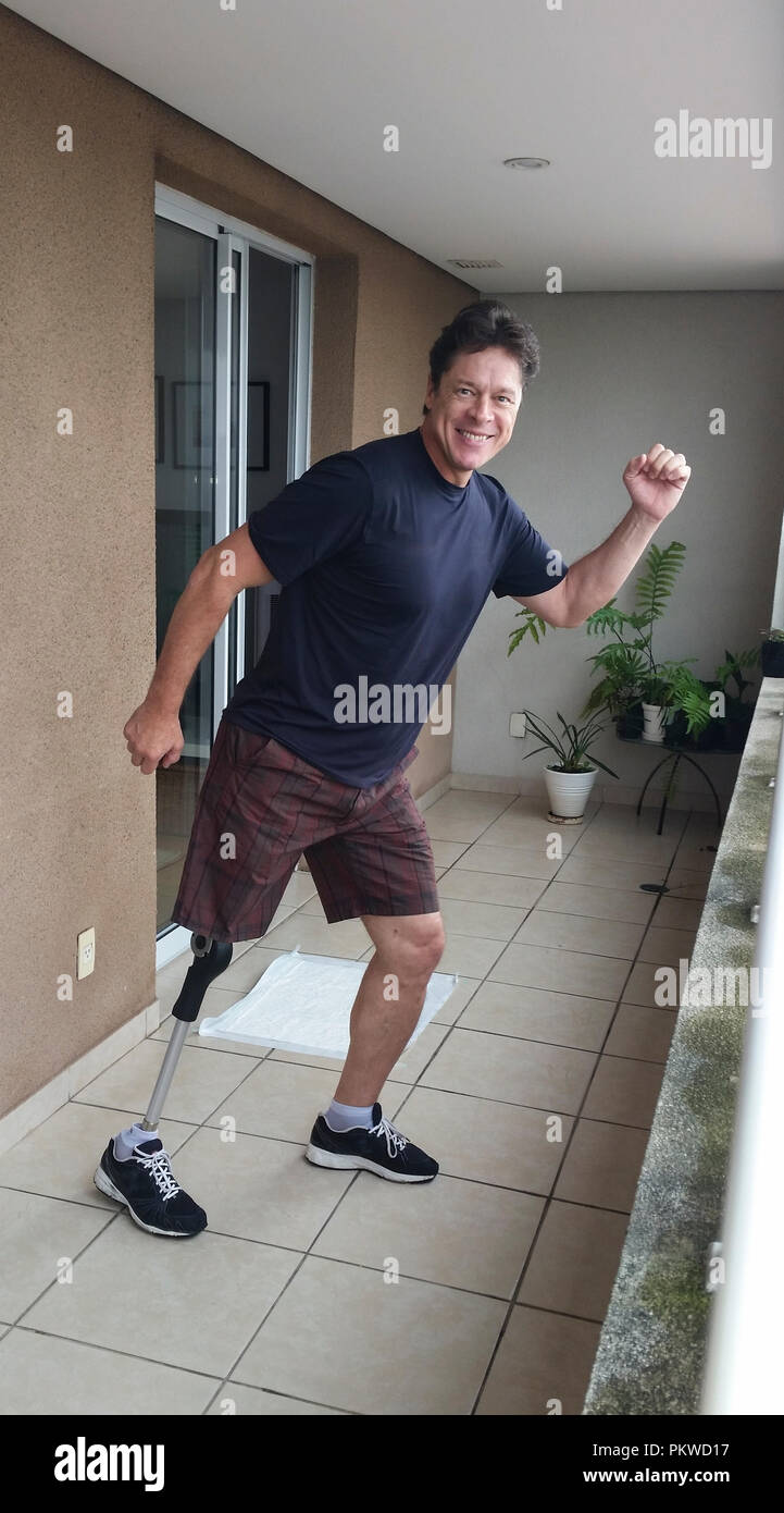 Amputated leg hi-res stock photography and images - Alamy