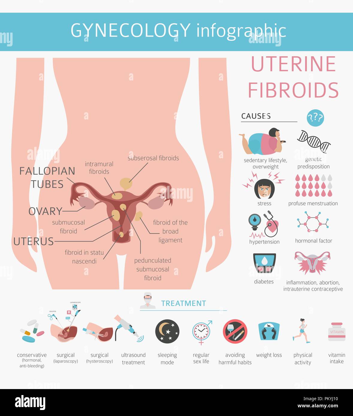 Uterine Fibroids Ginecological Medical Desease In Women Infographic