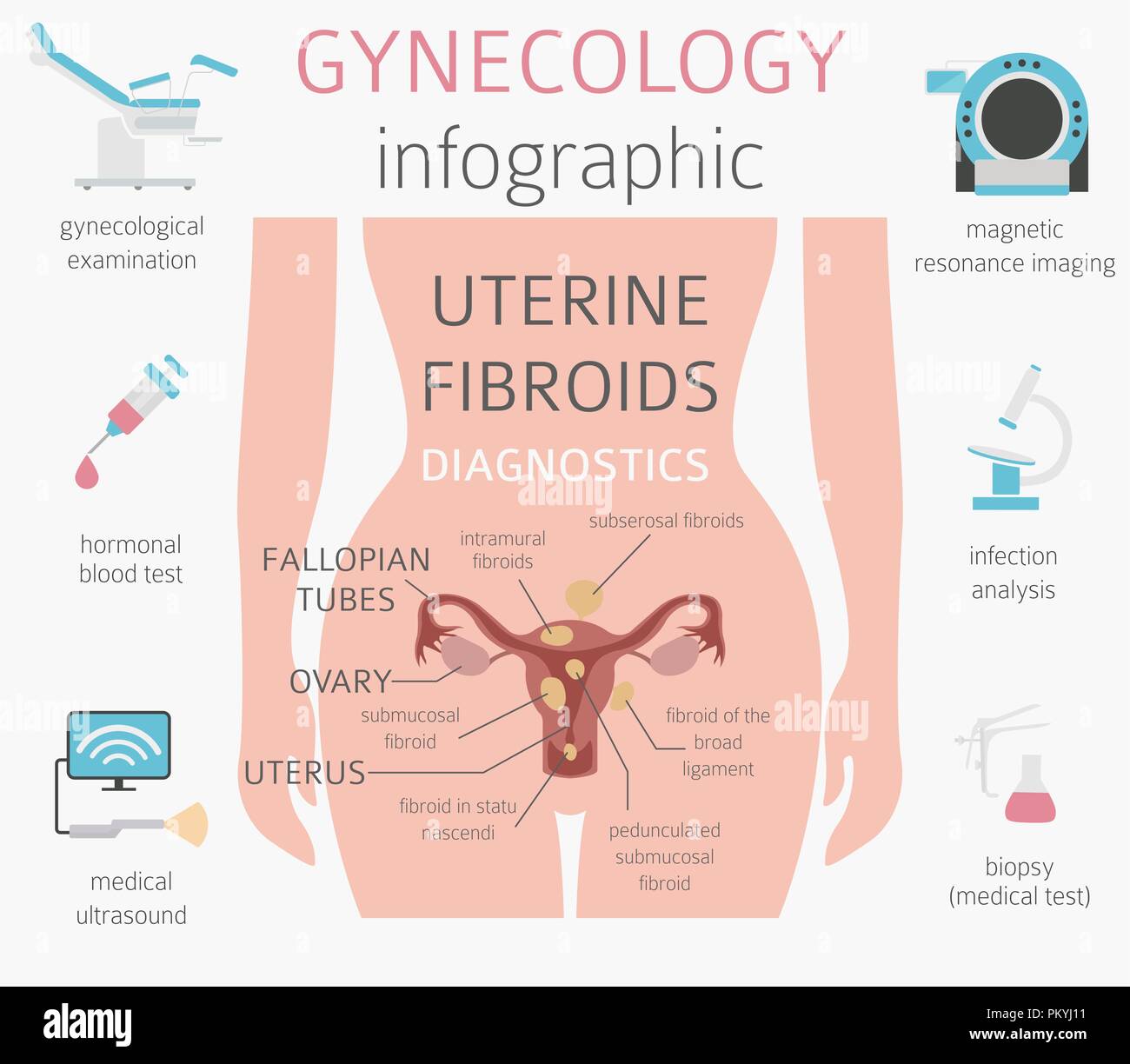 Uterine Fibroids Ginecological Medical Desease In Women Infographic