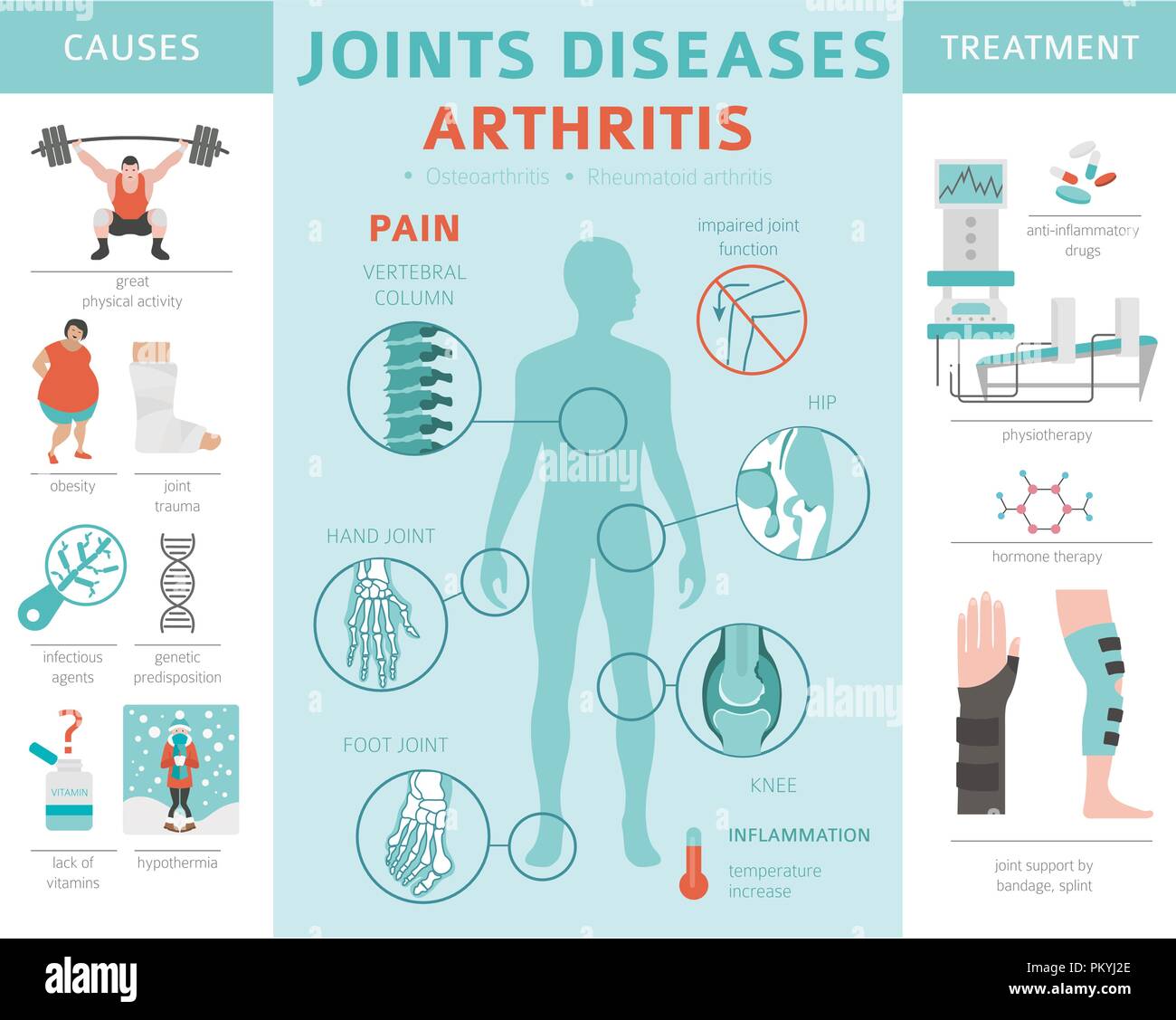 Joints diseases. Arthritis symptoms, treatment icon set. Medical ...