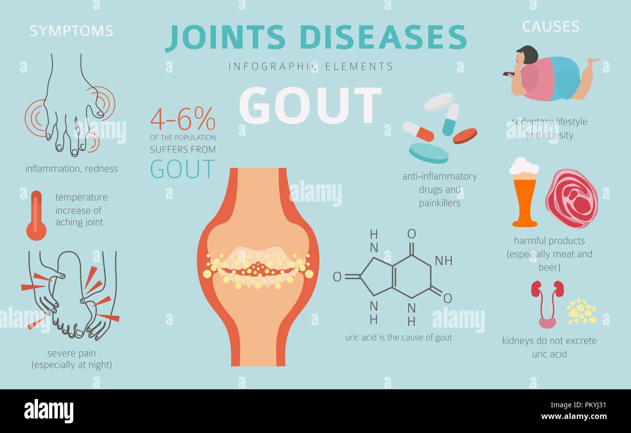 Joints diseases. Gout symptoms, treatment icon set. Medical infographic ...