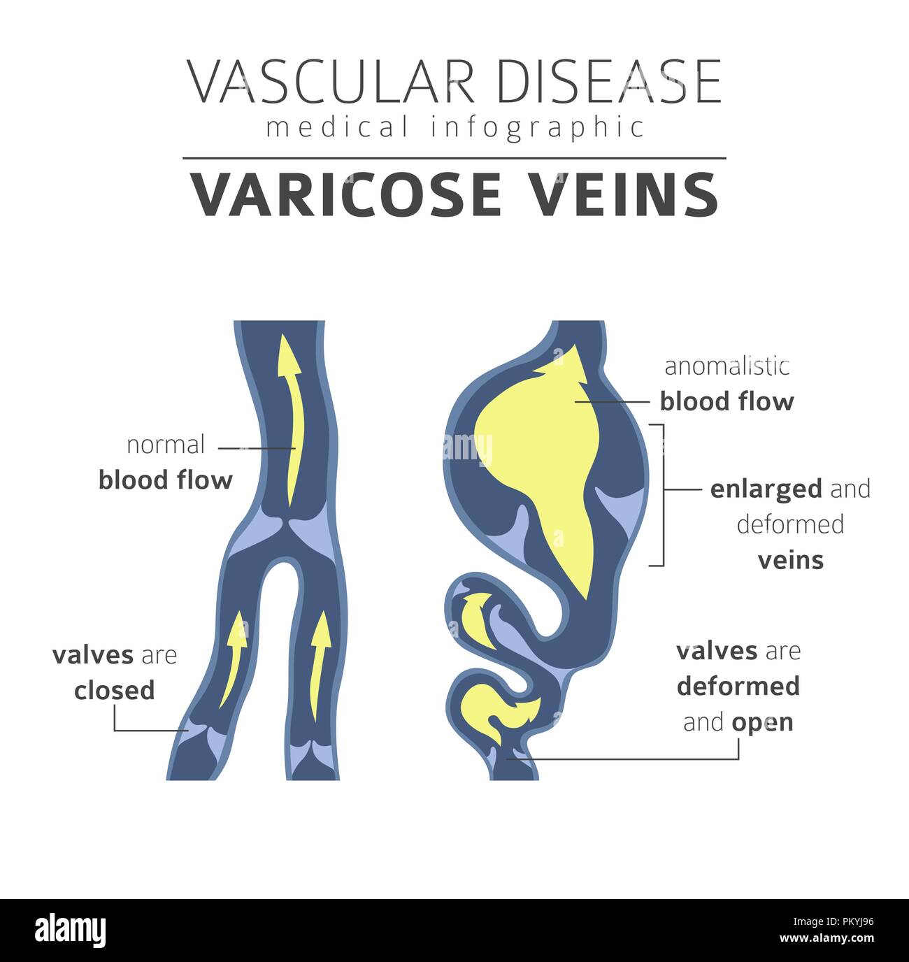 Vascular Diseases Varicose Veins Symptoms Treatment Icon Set Medical