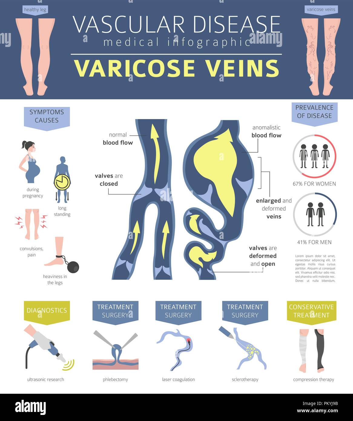 Vascular Diseases Varicose Veins Symptoms Treatment Icon Set Medical