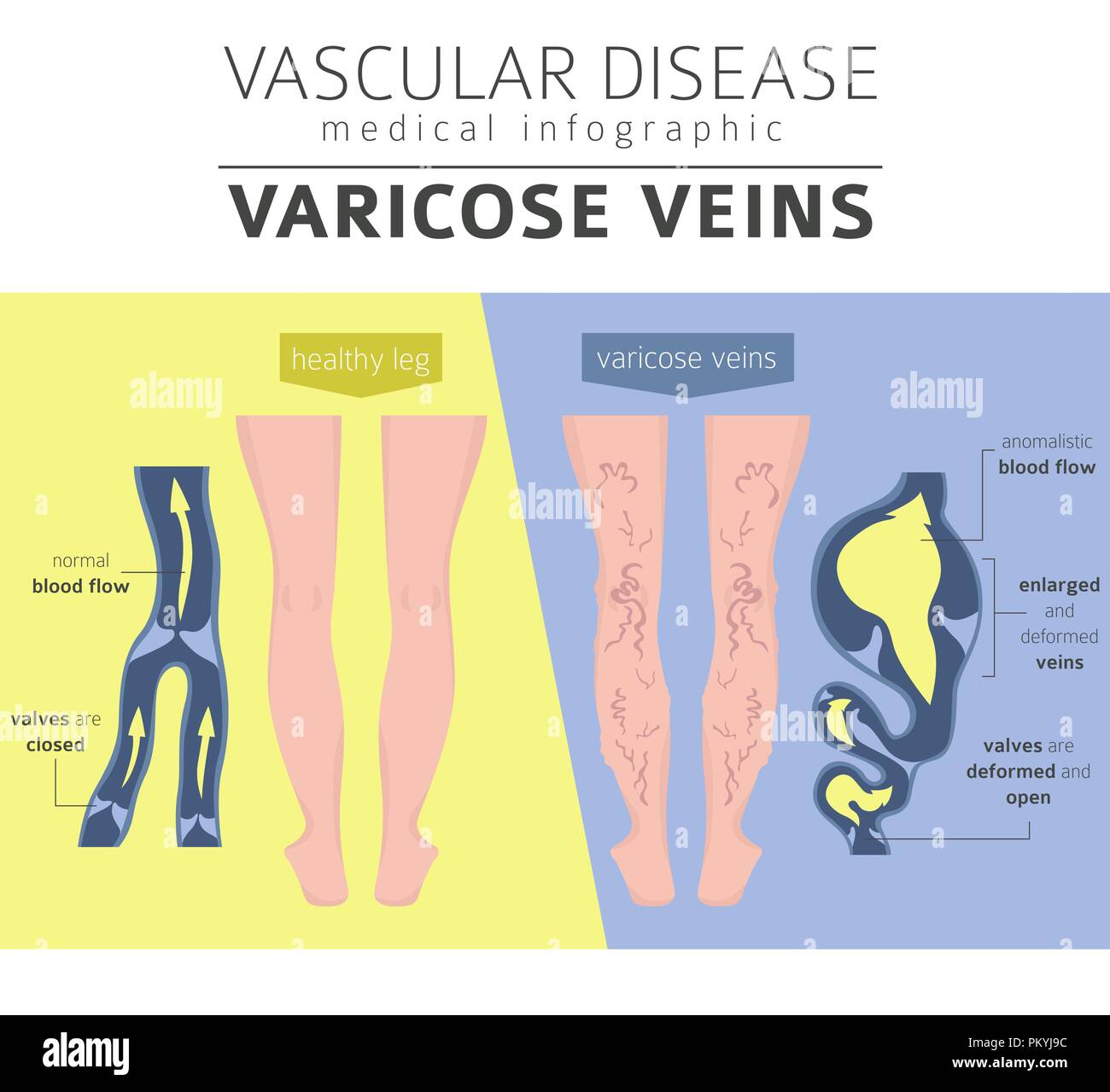 Vascular Diseases Varicose Veins Symptoms Treatment Icon Set Medical