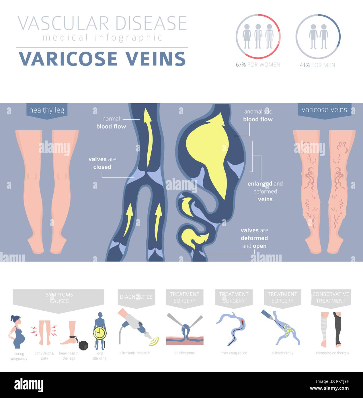 Vascular Diseases Varicose Veins Symptoms Treatment Icon Set Medical