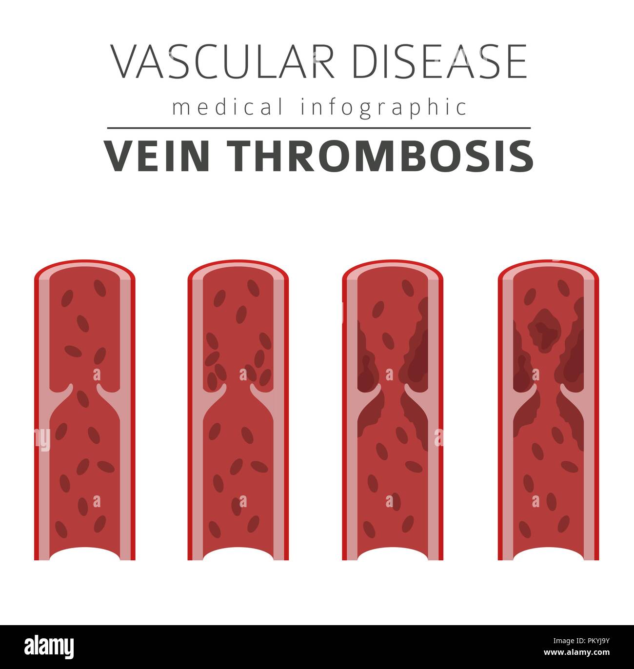 Vascular diseases. Vein thrombosis symptoms, treatment icon set ...