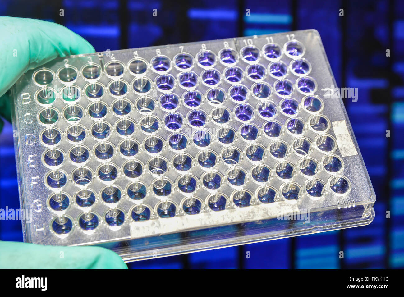 Laboratory DNA testing. 96-well plate on the background of the image of ...