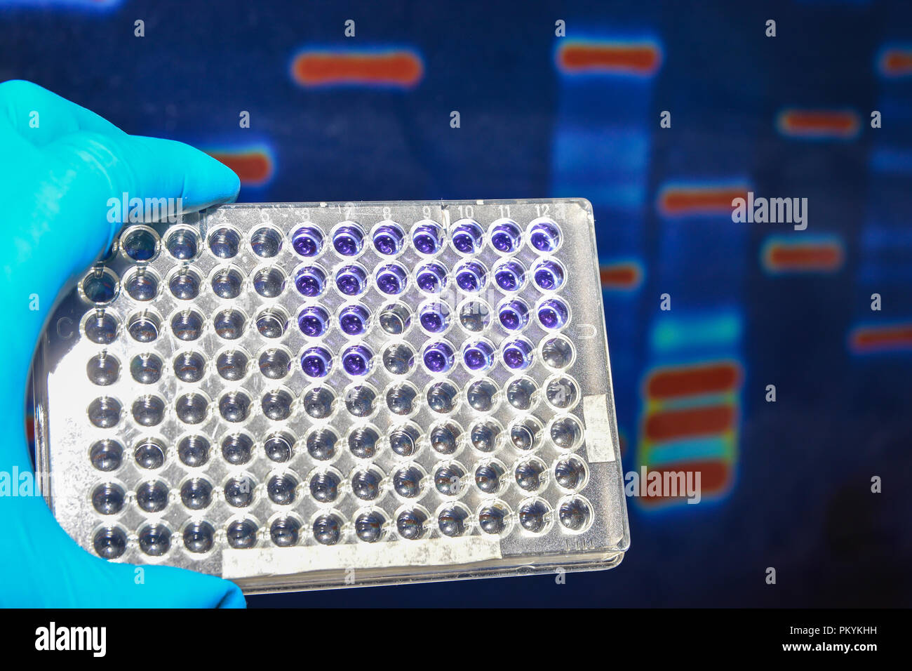 Laboratory DNA testing. 96-well plate on the background of the image of ...