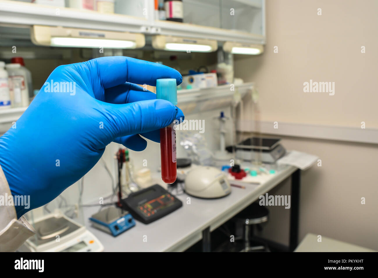 Blood testing in the laboratory. Clinical and biological research for ...