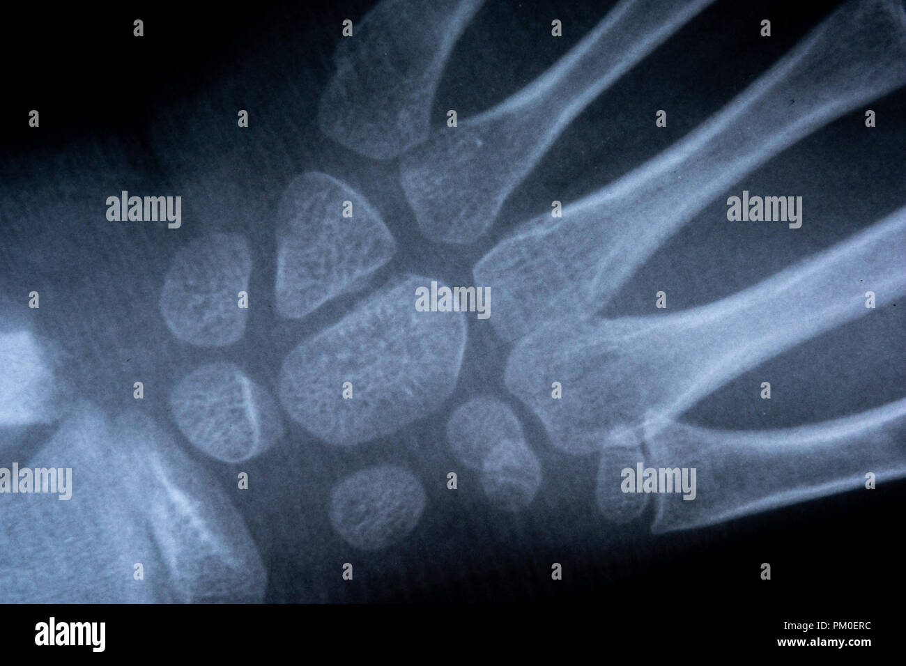 x-ray film skeleton human arm. health medical anatomy body concept ...