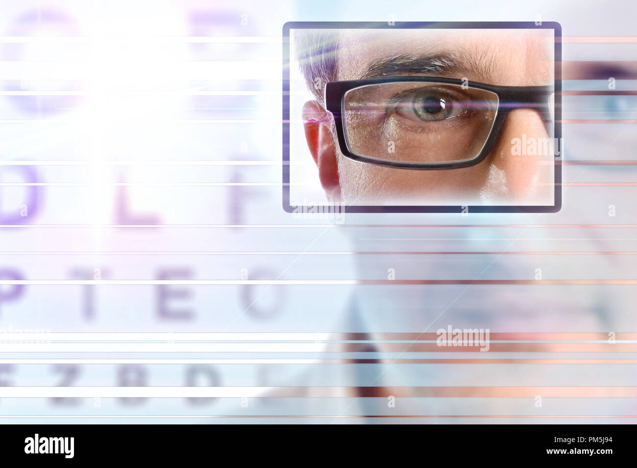 Representative concept of optical revision for visual correction with ...
