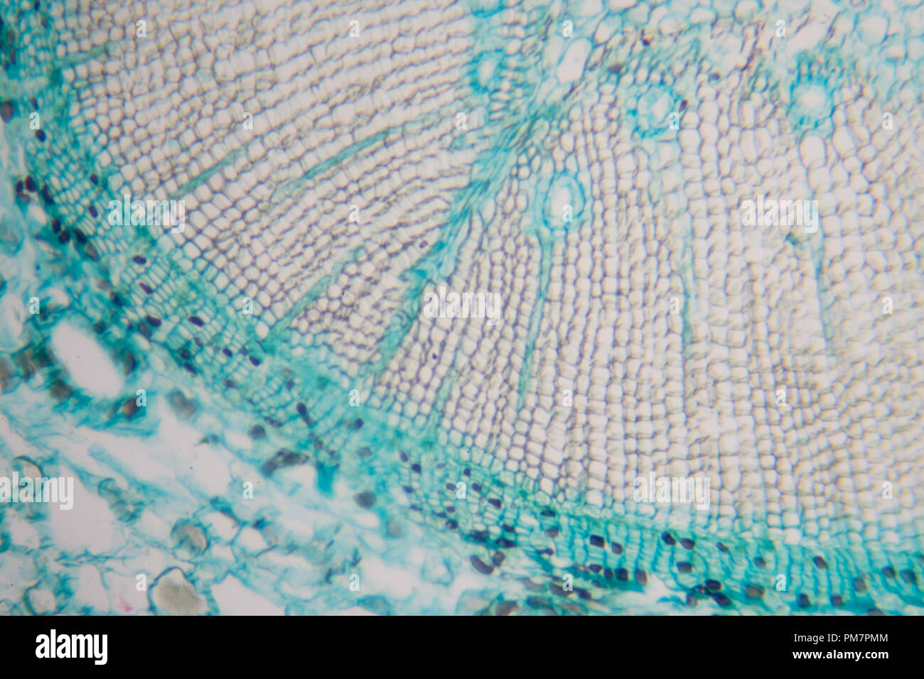 Onion cells microscope hi-res stock photography and images - Alamy