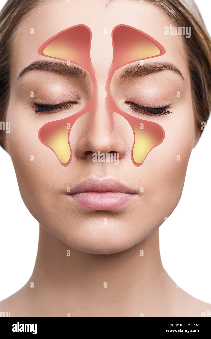 Female face shows nasal sinus with cold over white background Stock ...