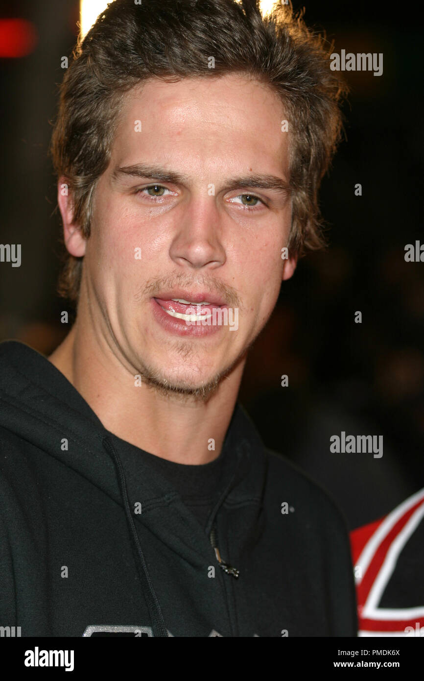 Jason Mewes Dentures