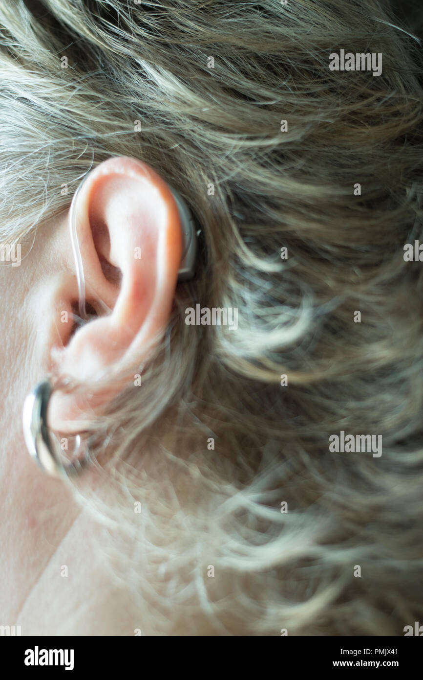 Deaf lady with modern technology digital hearing aid in her ear Stock ...