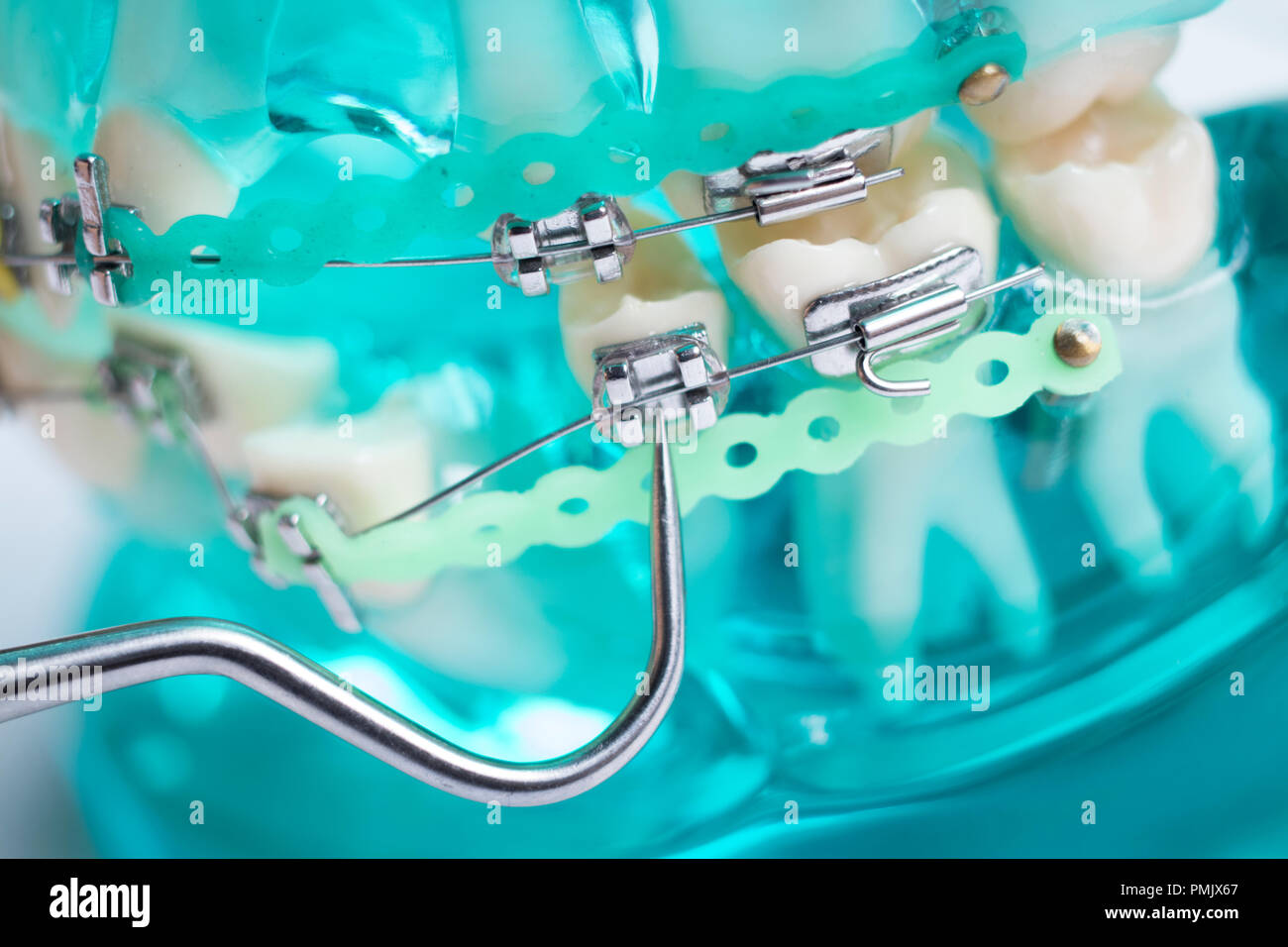 Dental metal braces teeth retainer aligners teaching orthodontics model ...