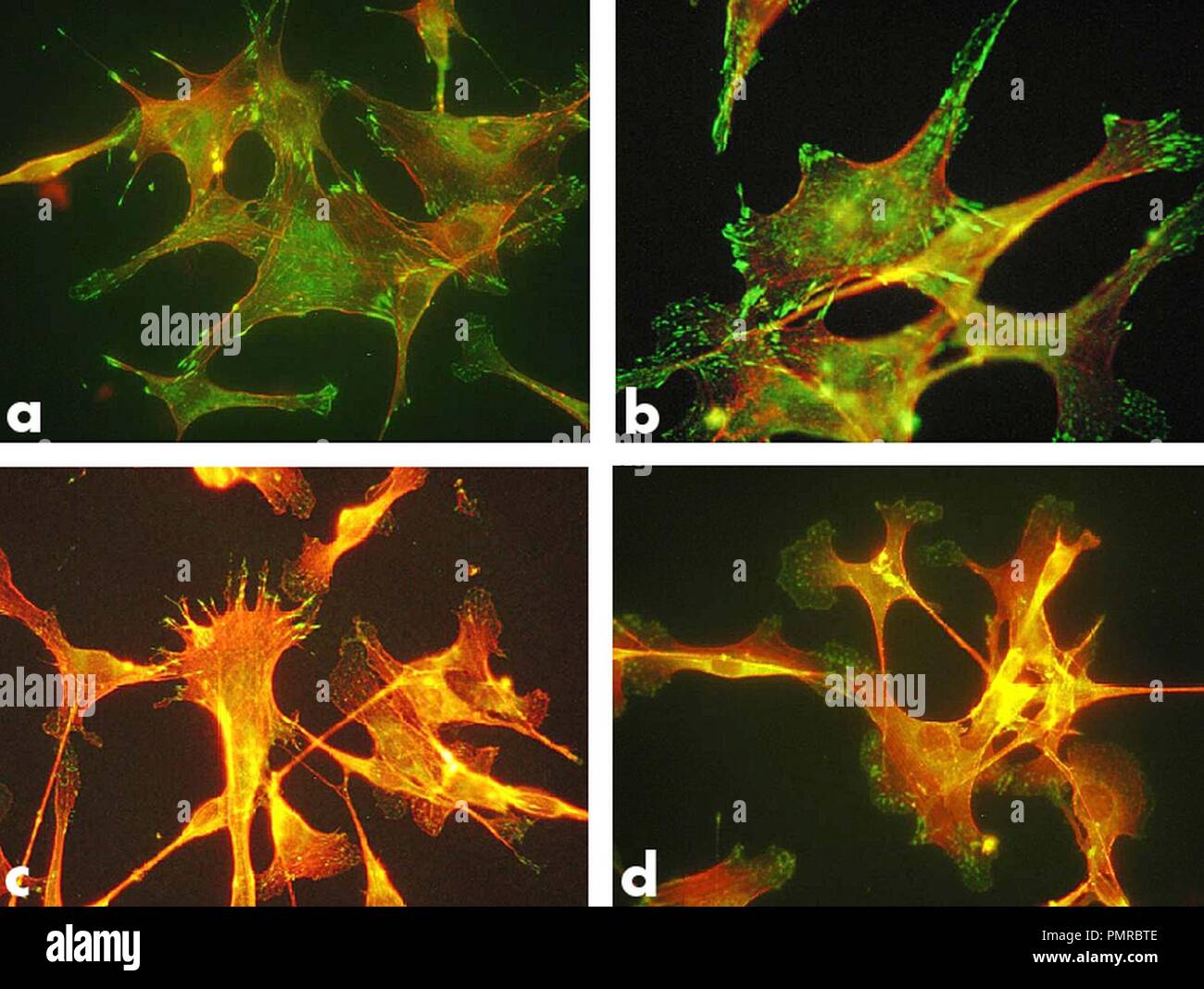 Collection of biomaterial hi-res stock photography and images - Alamy