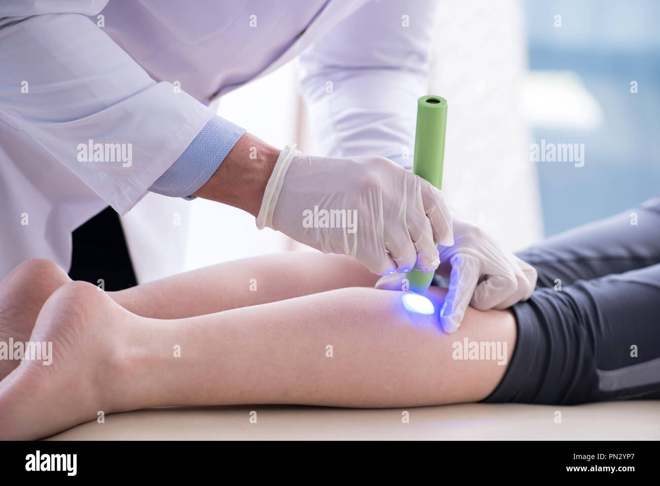 Patient in clinic undergoing laser scar removal Stock Photo - Alamy
