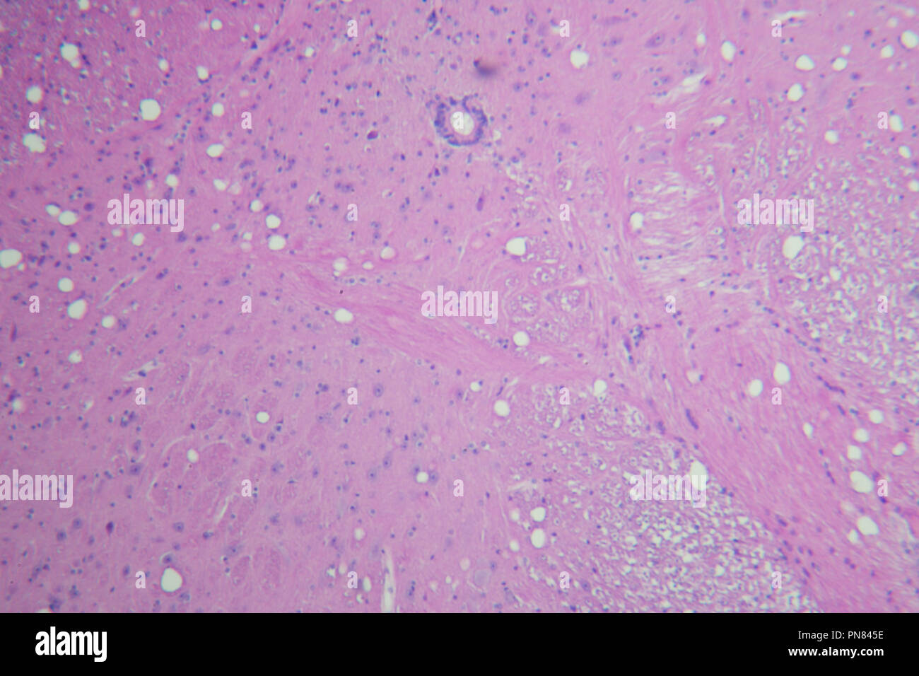 Cells in the microscope Stock Photo - Alamy