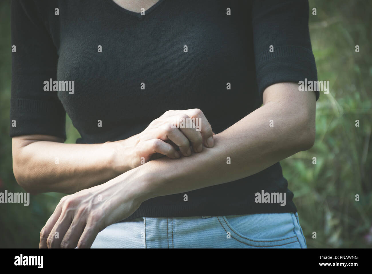 Itchy And Scratchy Stock Photos & Itchy And Scratchy Stock Images - Alamy