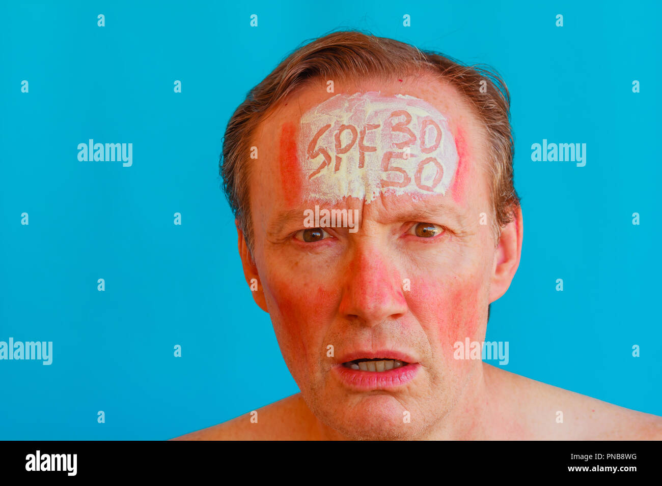 Erythema hi-res stock photography and images - Alamy