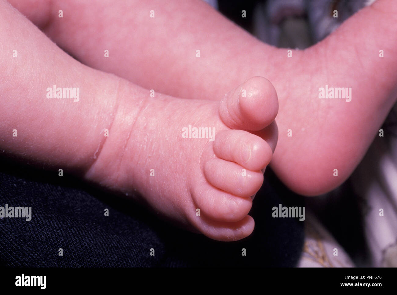 Old three toes hi-res stock photography and images - Alamy