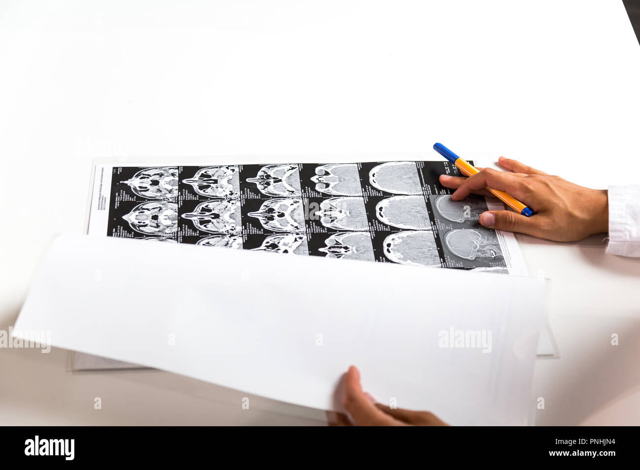 Human body cat scan hi-res stock photography and images - Alamy