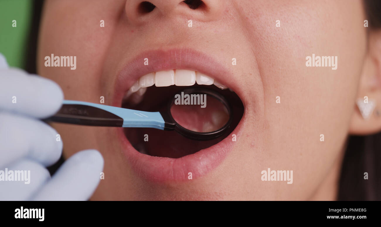 Hispanic girl getting her teeth checked on green screen Stock Photo - Alamy