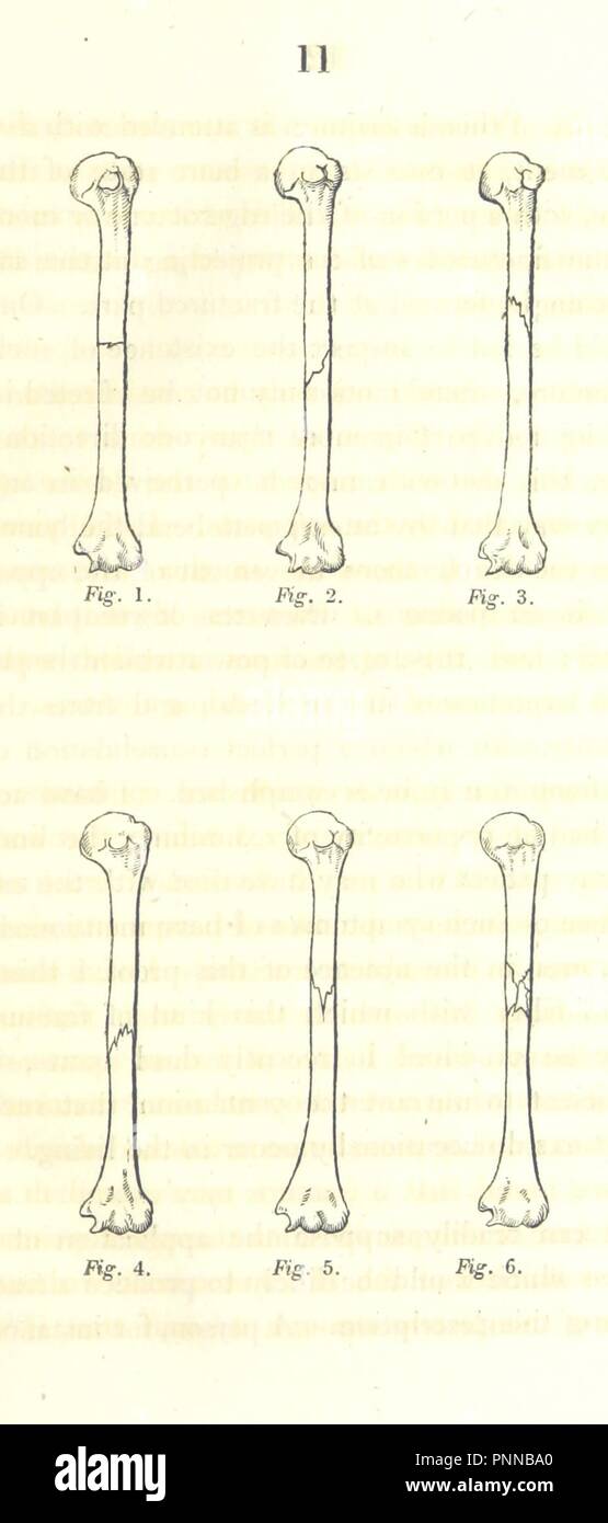 Image from page 29 of 'Practical Remarks on the Nature and Treatment of ...