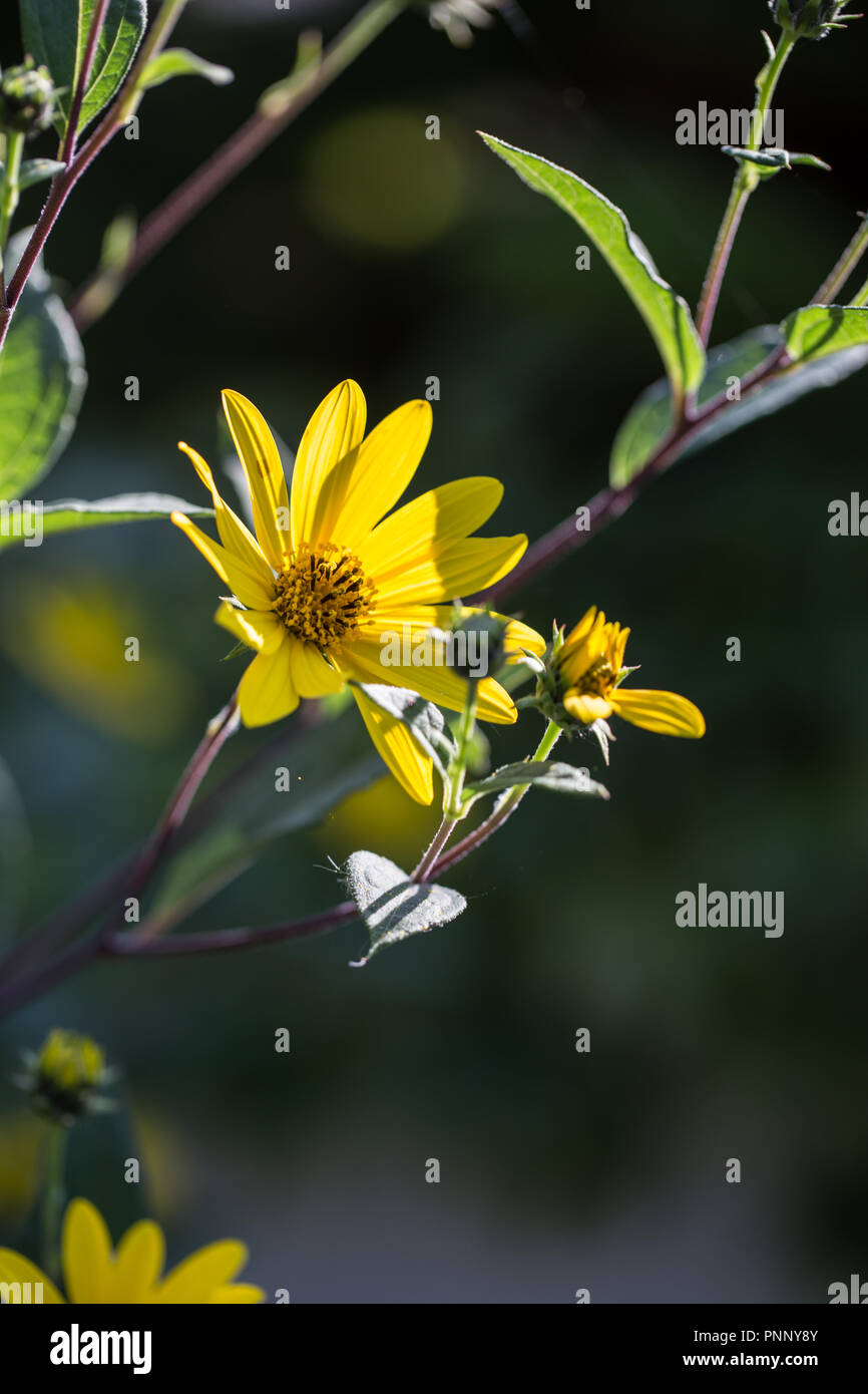 Microcephalus hi-res stock photography and images - Alamy