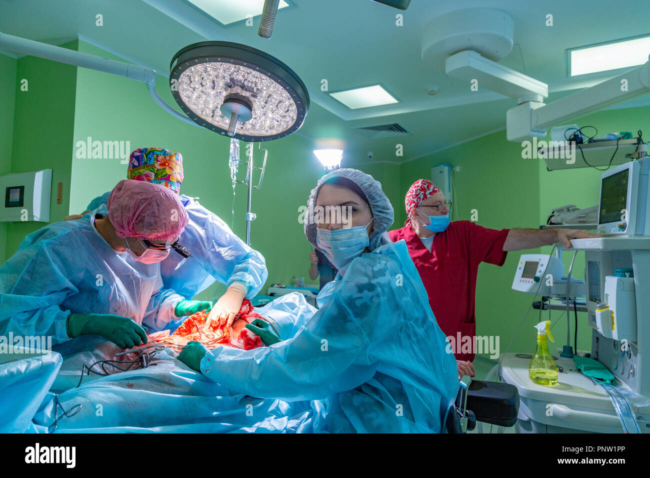 Surgical operation abdominoplasty. Close-up of the patient on the ...