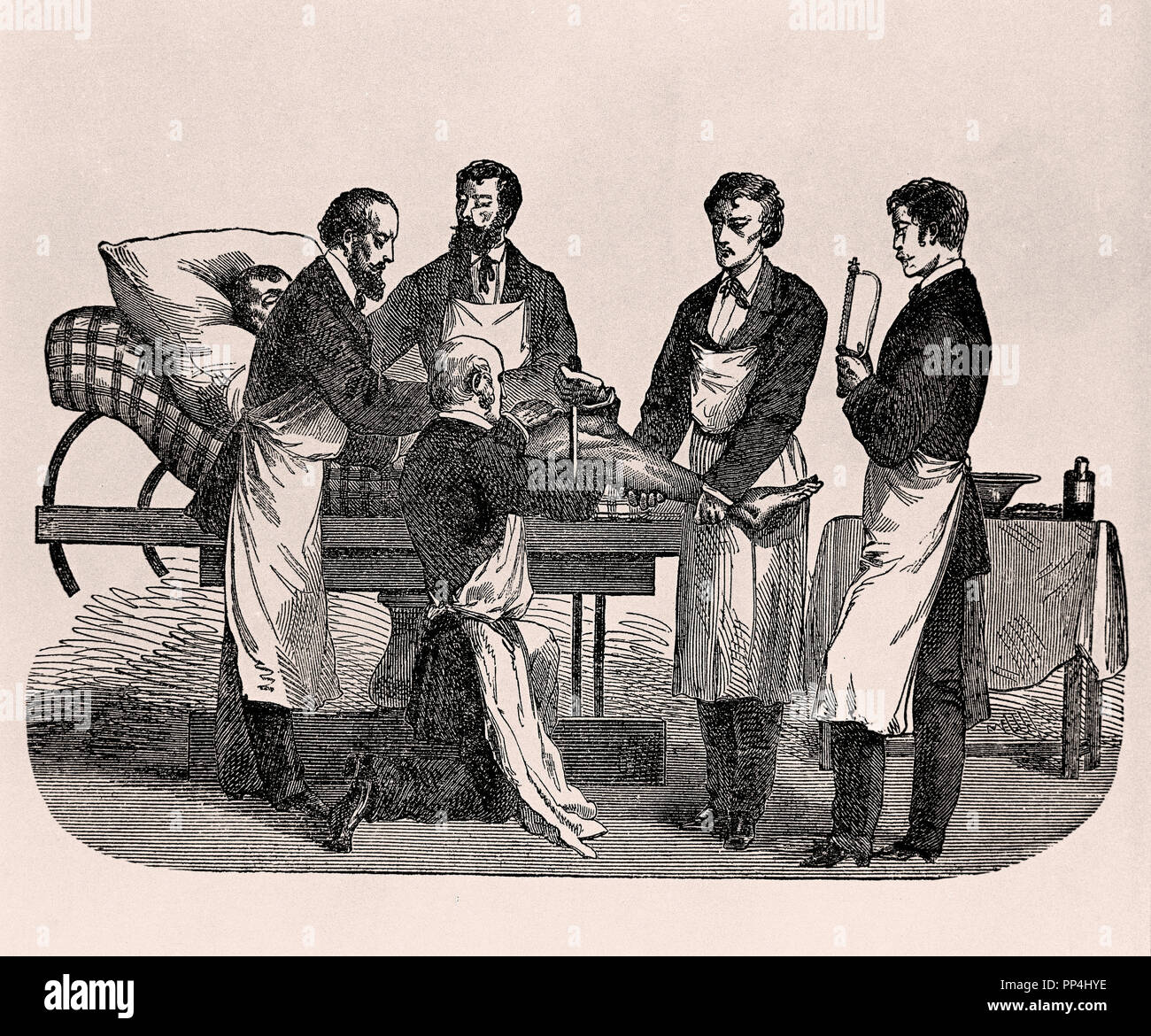 Amputation 19th century hi-res stock photography and images - Alamy