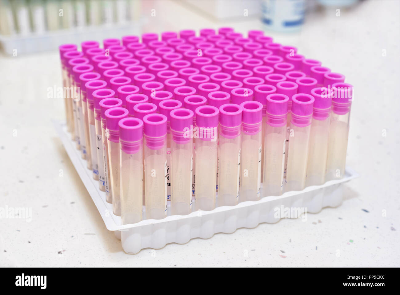 empty blood testing tube in laboratory Stock Photo - Alamy