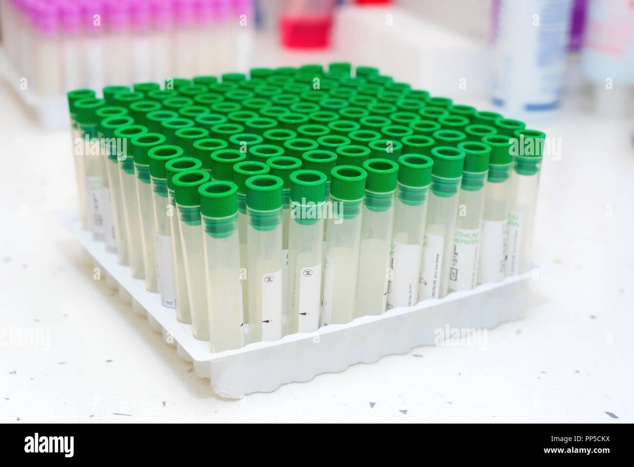 empty blood testing tube in laboratory Stock Photo - Alamy