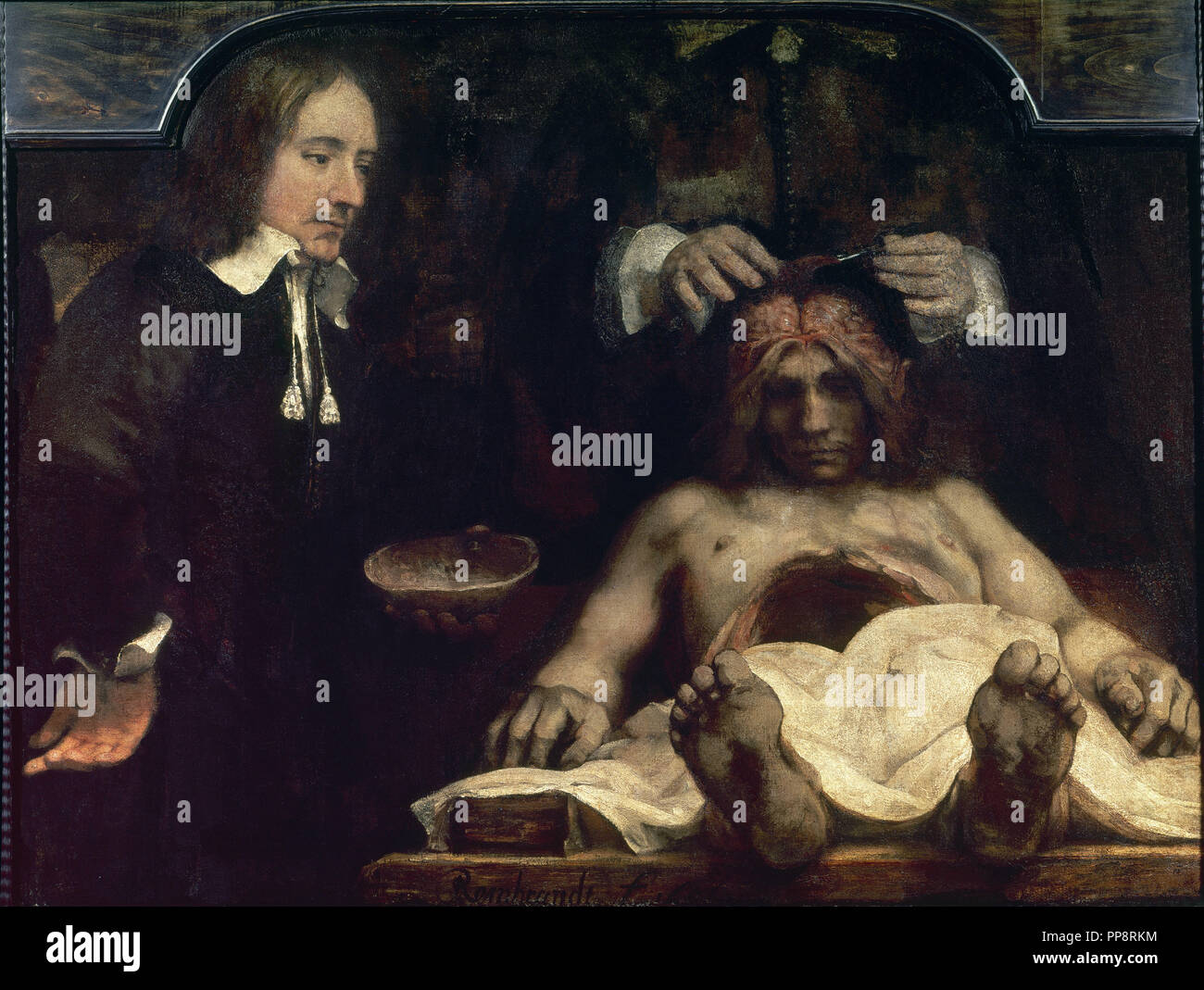 ANATOMY LESSON BY DOCTOR J. DEYMAN. Author: REMBRANDT, HARMENSZOON VAN ...