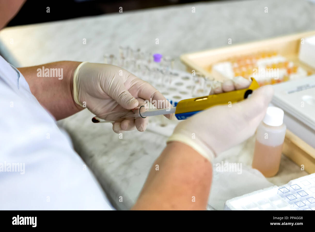 Laboratory equipment for blood analysis. The real work of the ...