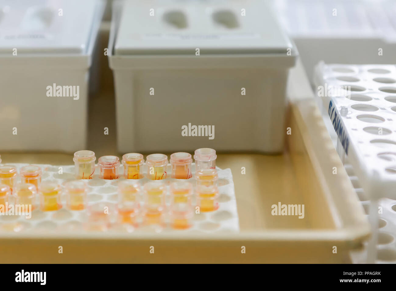 Laboratory equipment for blood analysis. The real work of the ...