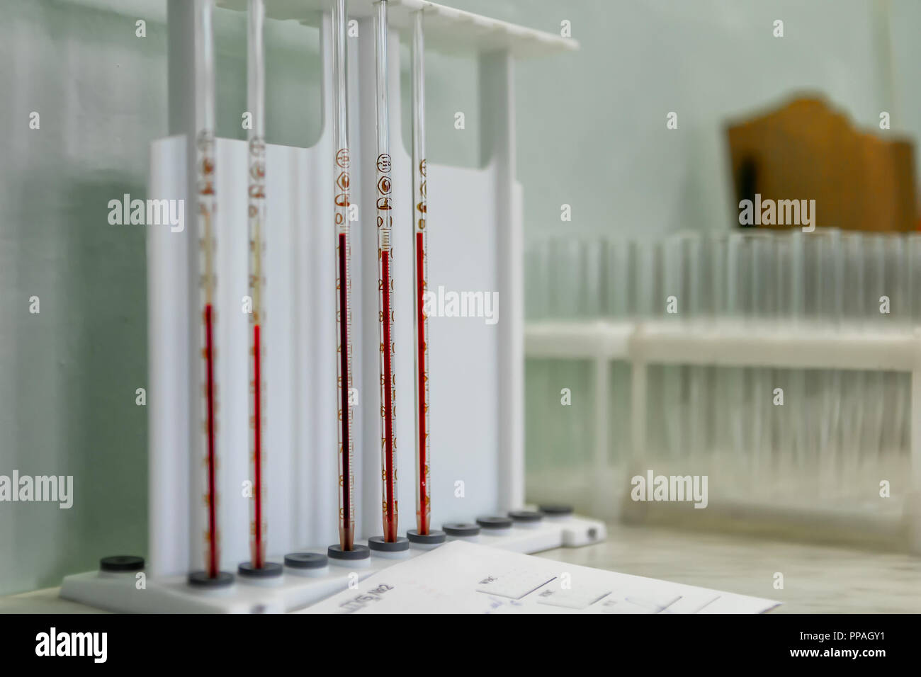 Laboratory equipment for blood analysis. The real work of the ...