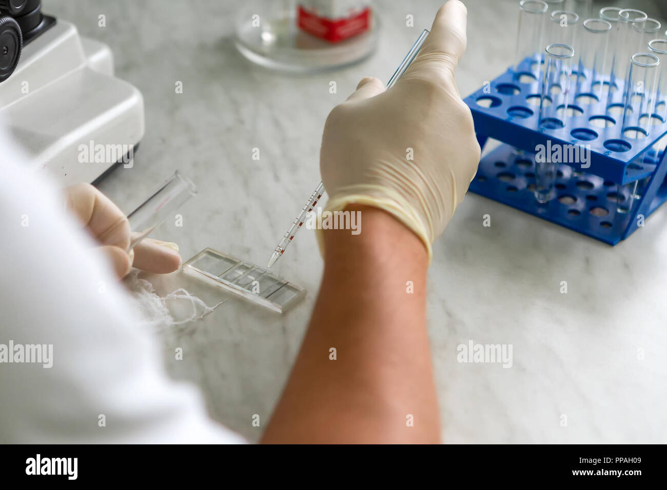 Old microscope. Real medical equipment for blood analysis Stock Photo ...