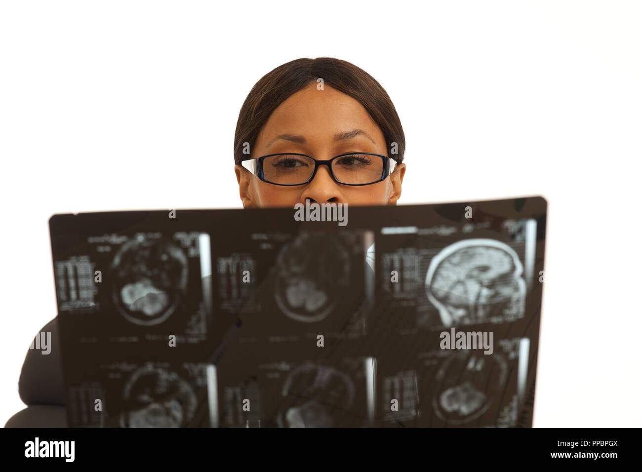 Closeup of young African doctor examining ct scan of patients cranium ...