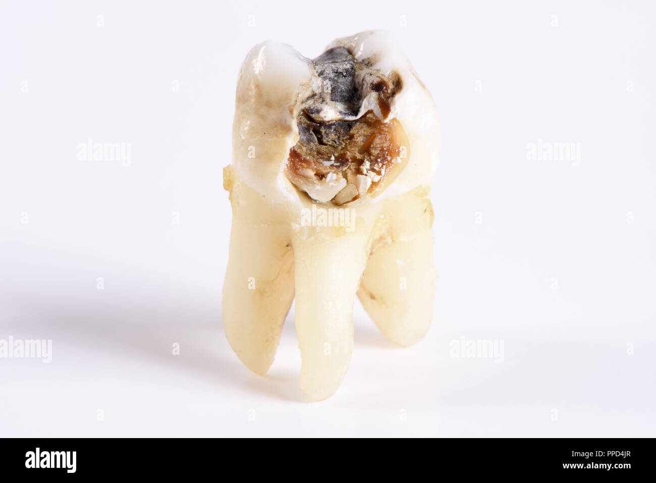 Extracted wisdom tooth with caries on white background Stock Photo - Alamy